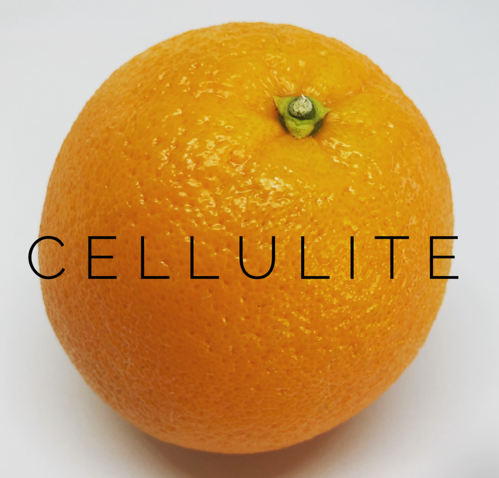 Cellulite - What You Can Do About it including a DIY Scrub that really ...